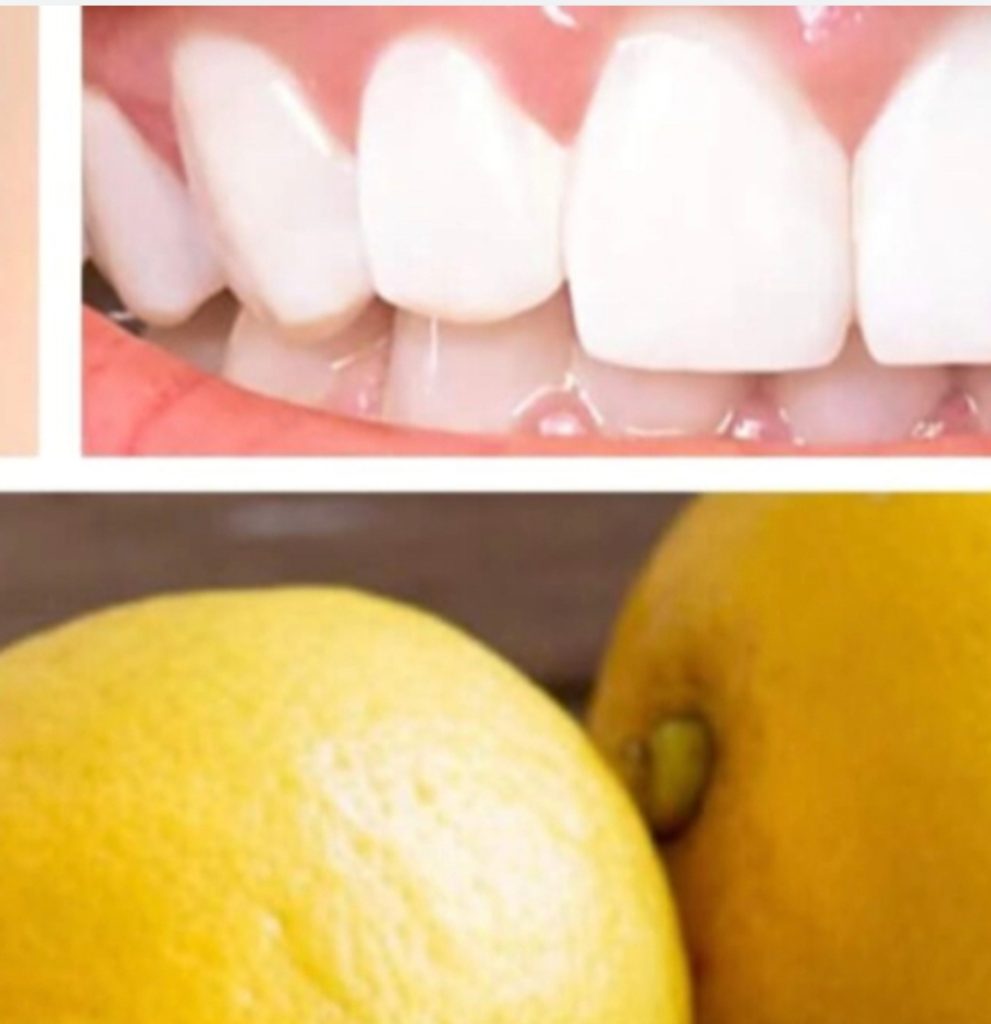 Brighten Your Smile in 2 Minutes: Transform Yellow Teeth to Shiny White ...